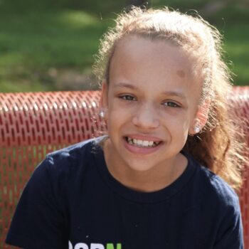 What are Café Au Lait Spots - Children's Tumor Foundation