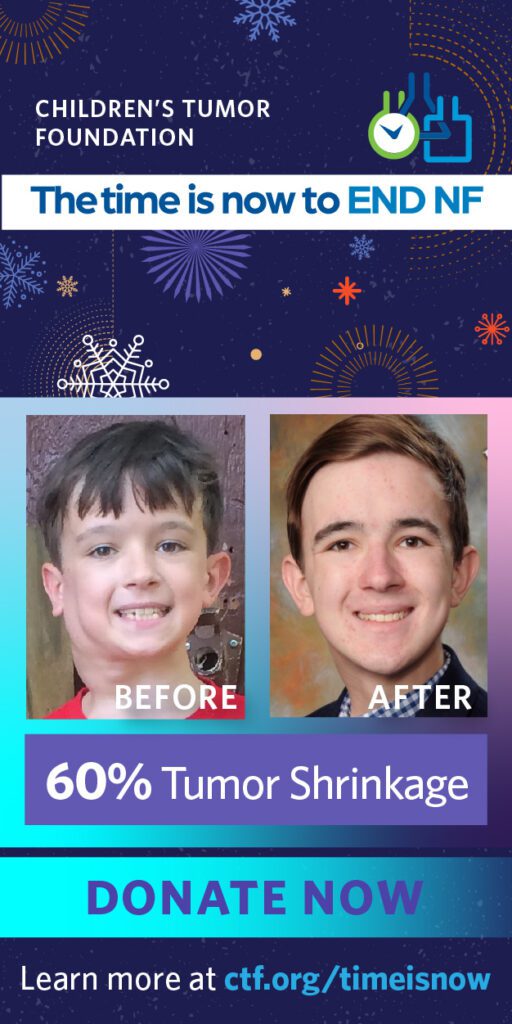 The Time is Now: Philip Moss - Children's Tumor Foundation