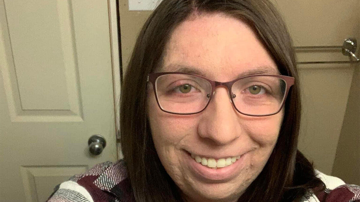 Stories of NF: Samantha G - Children's Tumor Foundation